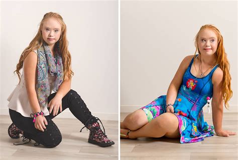 Maddy Stuart Teen With Down Syndrome Lands Her First Modelling