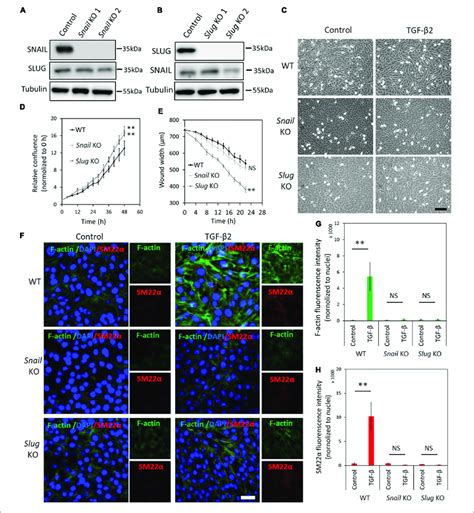 Depletion Of Snail Or Slug Attenuates Tgf β2 Induced Endmt In 2h11