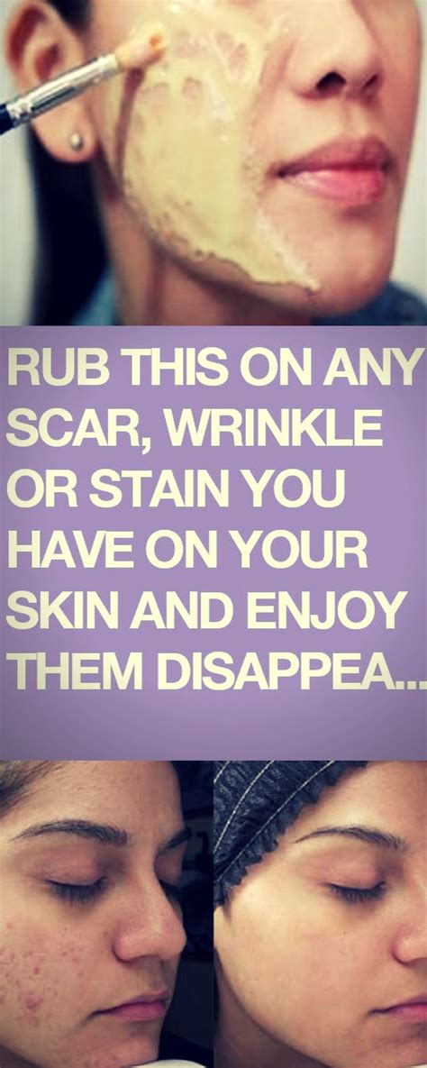 Rub This On Any Scar Wrinkle Or Stain You Have On Your Skin And Enjoy