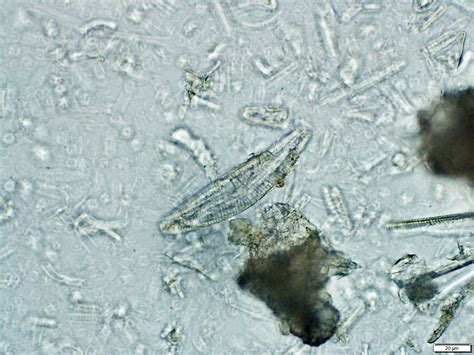 Diatomaceous Earth Under Microscope