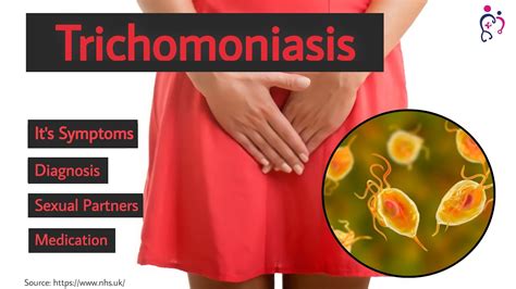 Trichomoniasis Trichomoniasis Cure Trichomoniasis Test