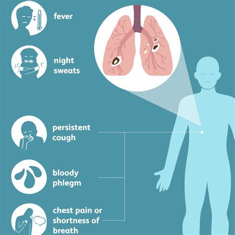 Tuberculosis Everything About The Symptoms Diagnosis And Treatment Of