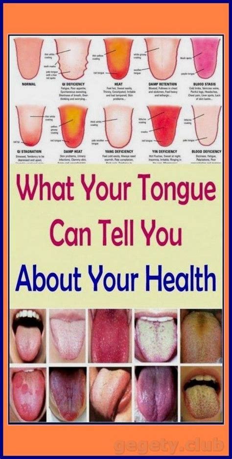 What Does Your Tongue Say About Your Health Artofit