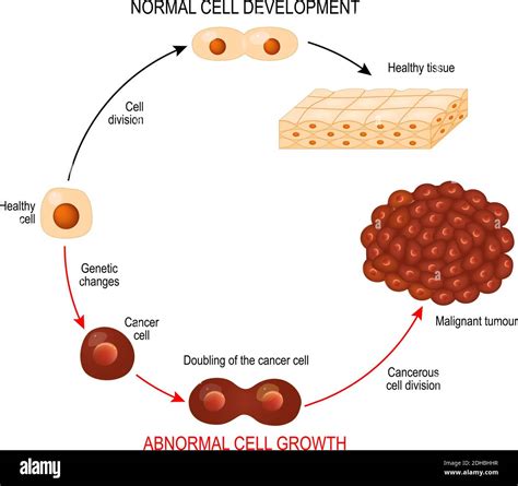Cancer Cell And Normal Cell Healthy Tissue And Malignant Tumour