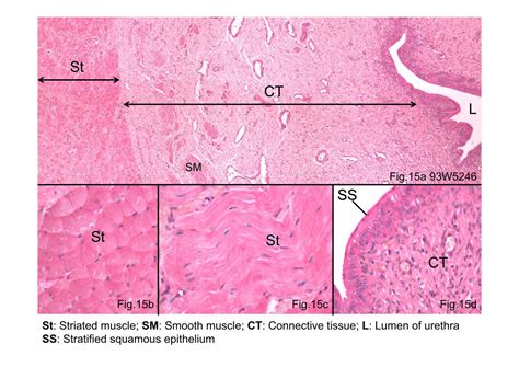 Stratified Columnar Epithelium Urethra