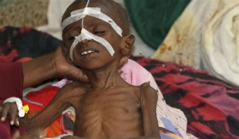 Ajuda Para As CrianÇas Que EstÃo Morrendo De Fome Na África Vaquinhas