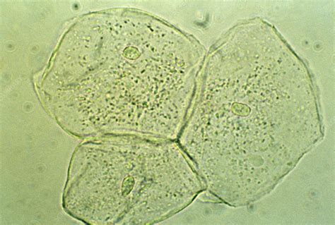Cheek Cell Under Light Microscope