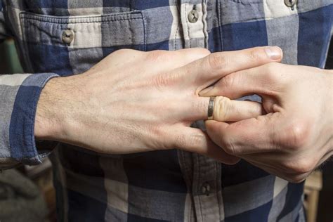 Remove A Ring From Swollen Finger