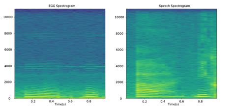 A Comparison Between The Spectrograms Of Egg Signals And Speech Signals
