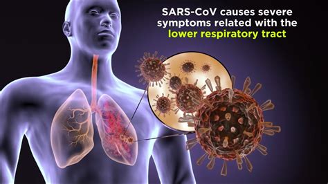 Severe Acute Respiratory Syndrome Sars Youtube