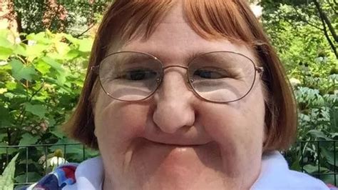 Disabled Blogger Told She Was Too Ugly For Selfies Keeps On Posting