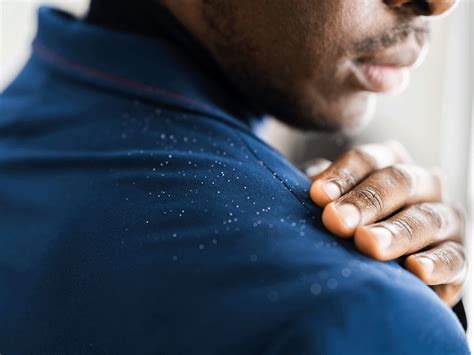 Whats The Difference Between Dandruff And Dry Scalp Pilot