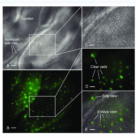Sperm Cells Detected In The Lumen Of A Mouse Cauda Epididymidis Have