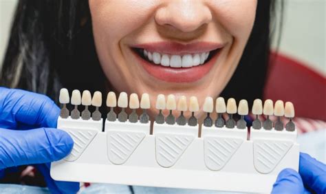 The Benefits Of Porcelain Veneers Restoring Teeth