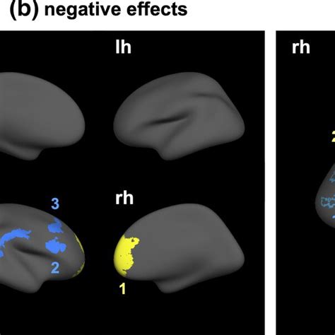 Sex‐independent Effects Of Early Life Stress On Vertex‐wise Lgi