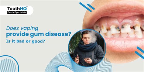 Does Vaping Provide Gum Disease Is It Bad Or Good Toothhq Dental