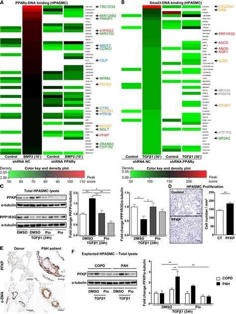 Pparγ Links Bmp2 And Tgfβ1 Pathways In Vascular Smooth Muscle Cells