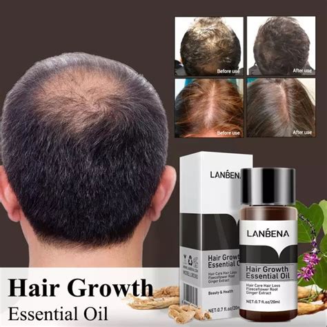 Lanbena Hair Growth Essential Oil Hair Loss Treatment Prevent Baldness