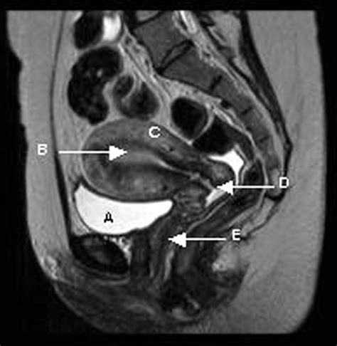 Anatomy Of The Female Pelvis The Bmj