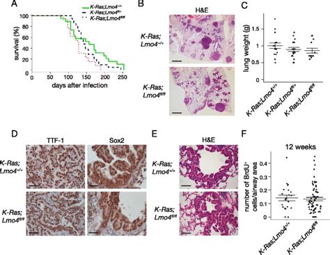 Loss Of Lmo4 Does Not Alter Overall Survival In Mouse Model Of Lung