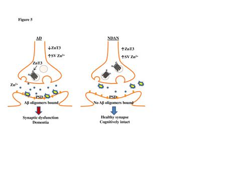 Aβ And Zn2 Differences In Ad And Ndan Hippocampal Synapses A Schematic