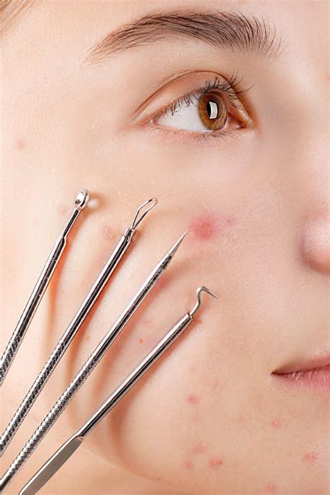 A Beginners Guide To Facial Extractions Nyc Massage And Spa