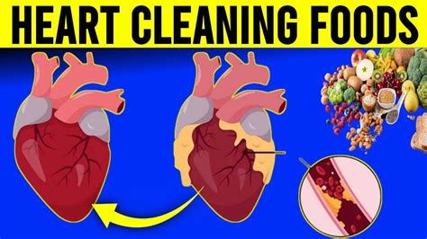 Top 7 Best Foods To Clean Out Your Arteries Naturally And Prevent Heart