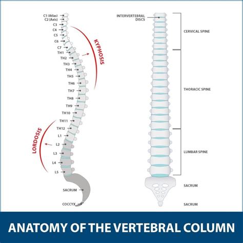 Kyphosis Symptoms Treatment Florida Orthopaedic Institute