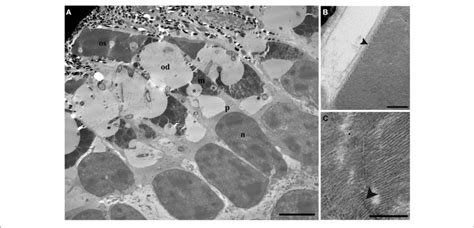 Transmission Electron Micrographs Detailing The Ultrastructure Of A