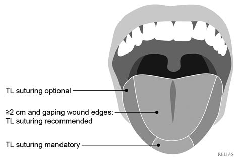 Pediatric Facial Lacerations In The Emergency… Relias Media