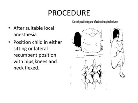 Lumbar Puncture Ppt