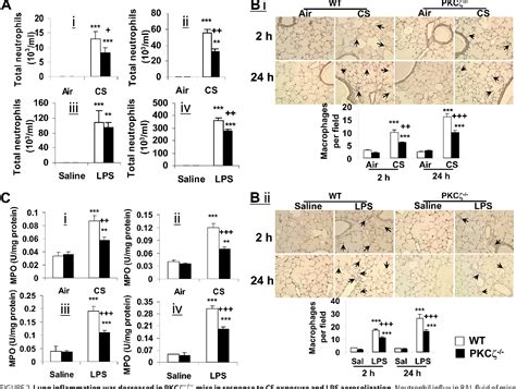 Figure 2 From Protein Kinase C Mediates Cigarette Smoke Aldehyde And