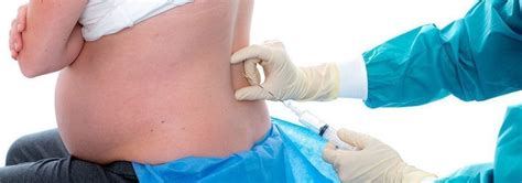 The Facts Behind An Epidural