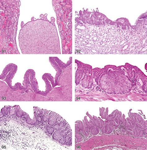 Proliferative And Nonproliferative Lesions Of The Rat And Mouse Urinary