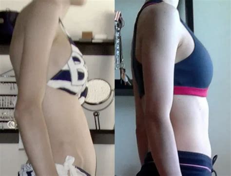 How To Get Rid Of Skinny Arms The Simple Guide For Both Males