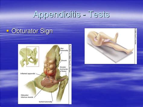 Ppt Gastroenterology Pathology Powerpoint Presentation Free Download