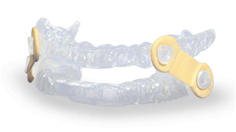 Mandibular Advancement Device Ema® Oral Appliance