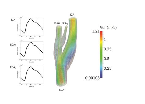 The Figure Illustrates The Waveform At The Inlet Cca And The Pressure