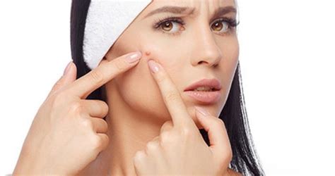 Purifying Acne Treatment Sedalicious