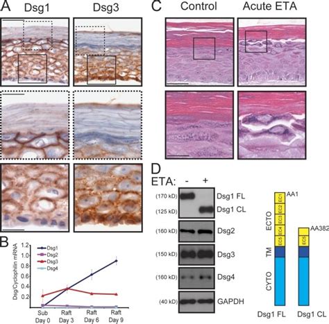 Differentiation Dependent Dsg1 Maintains Adhesion In The Superficial