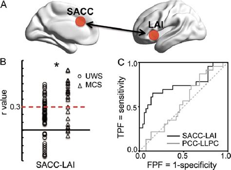 A Schemata Of The Functional Connectivity Between Supragenual