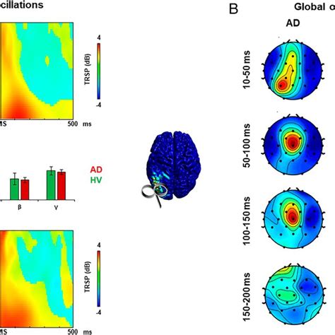 Oscillatory Activity Analysis After Left Posterior Parietal Cortex