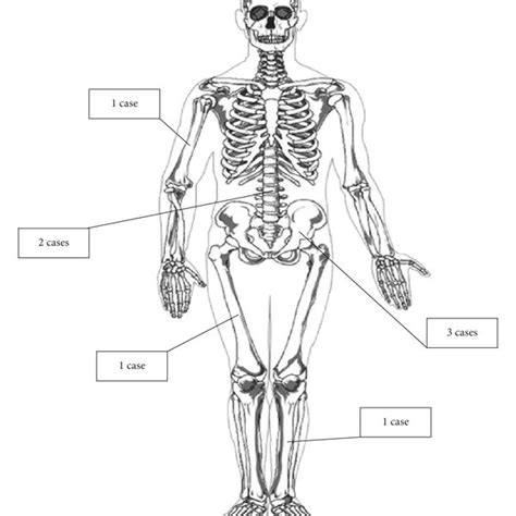 Absolute Numbers Of The Anatomical Distribution Of Bone Ce Lesions In