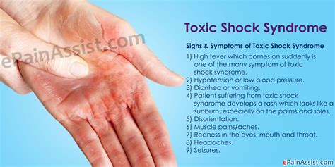 Toxic Shock Syndrome Causes Fingersandfeathersh