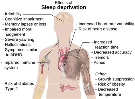 Mecandf Expert Engineers Sleep Deprivation Affects Cognitive Function