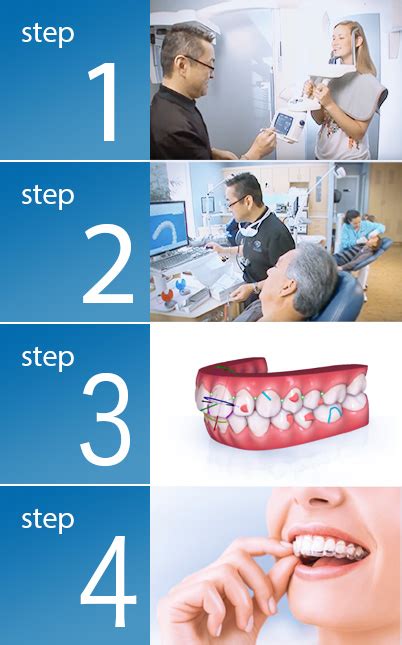 Invisalign® Treatment Torrance Ca Noguchi Orthodontics