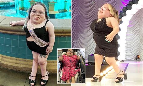 Three Foot Tall Woman With Rare Form Of Dwarfism Working As Fashion
