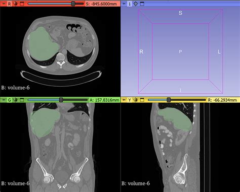software to visualize annotate dicom nifti files pycad