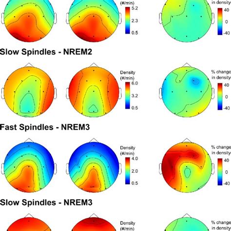 Topographic Distribution Of The Density Of Fast And Slow Spindles