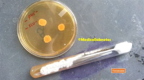 Fonsecaea Introduction Morphology Pathogenicity Lab Diagnosis